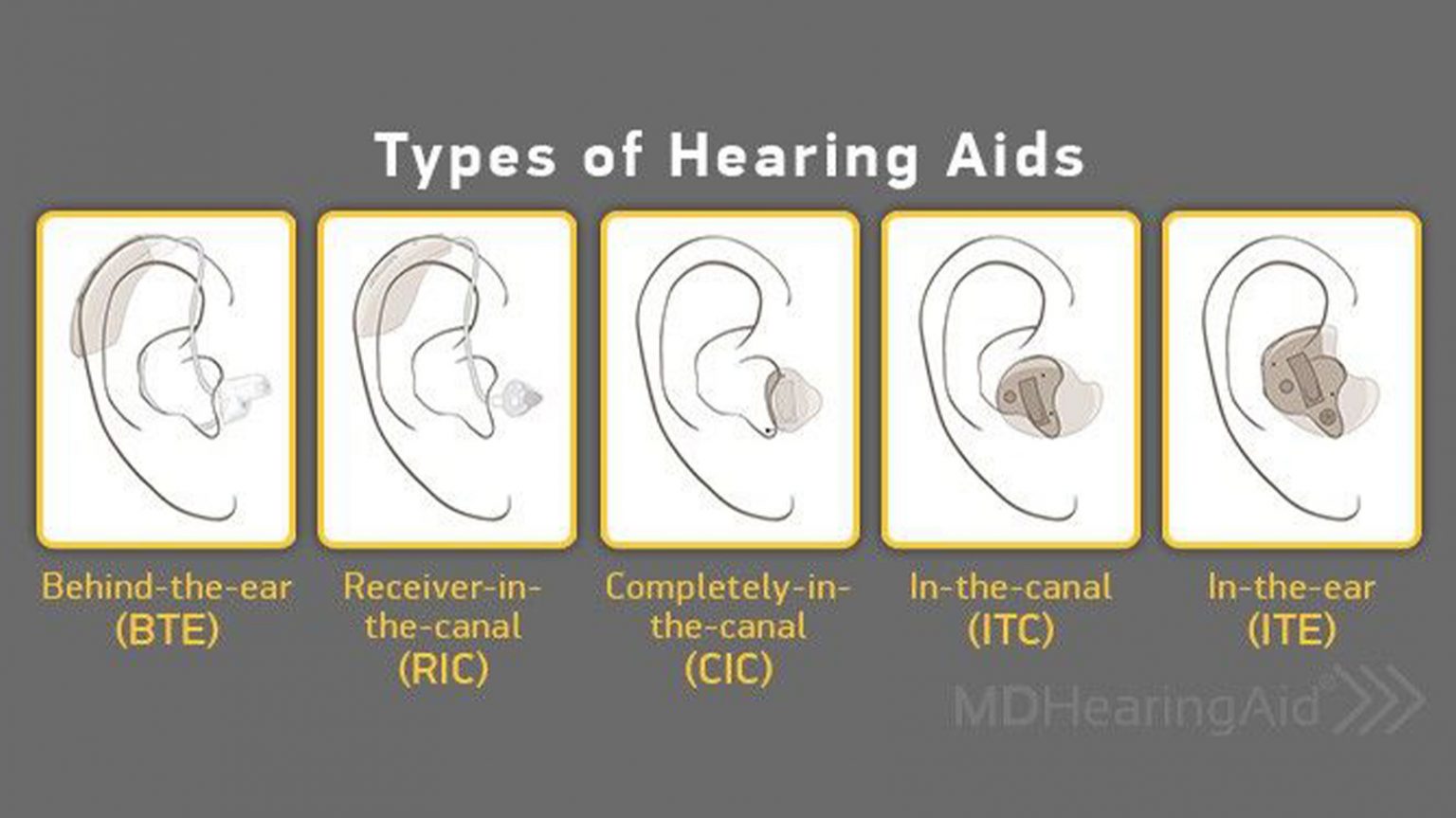 A guide to hearing aids: What kind is best for you? - SoundGuys